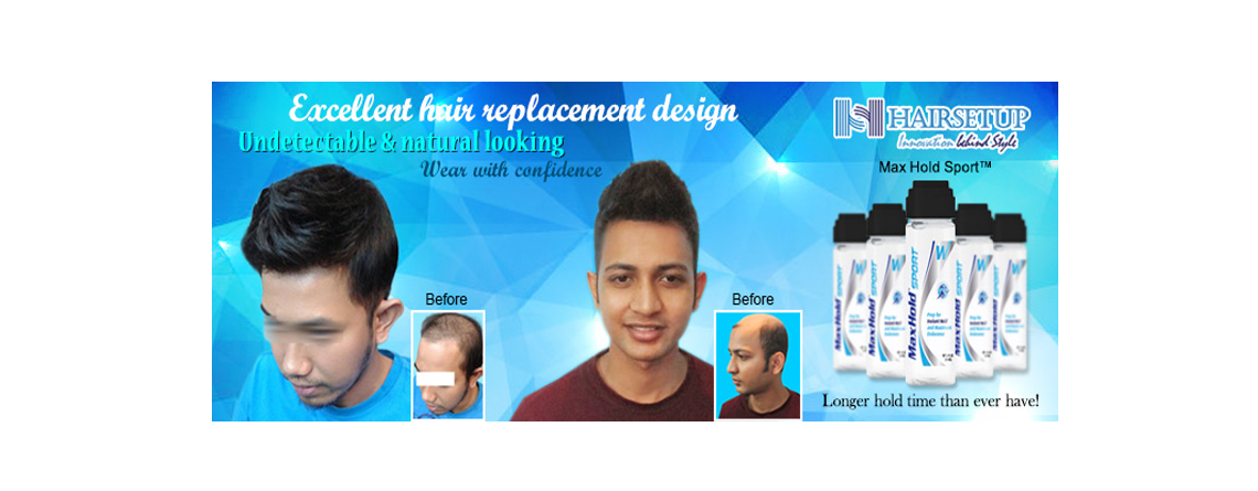 Custom Hair Replacement Systems and Toupees for Men and Women with Hair ...